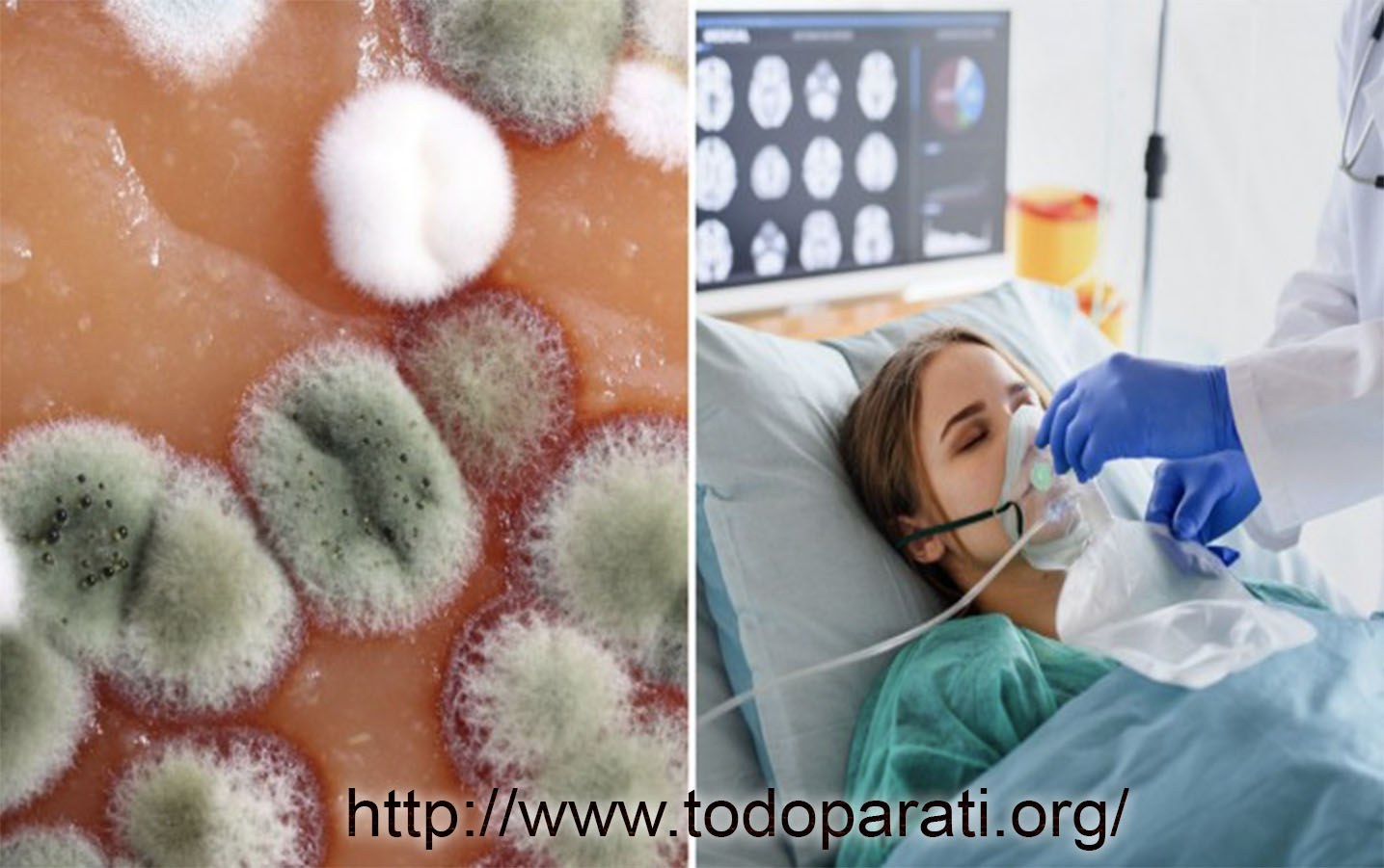 ¿Qué es la Candida auris? El hongo resistente a fármacos que se puede ...